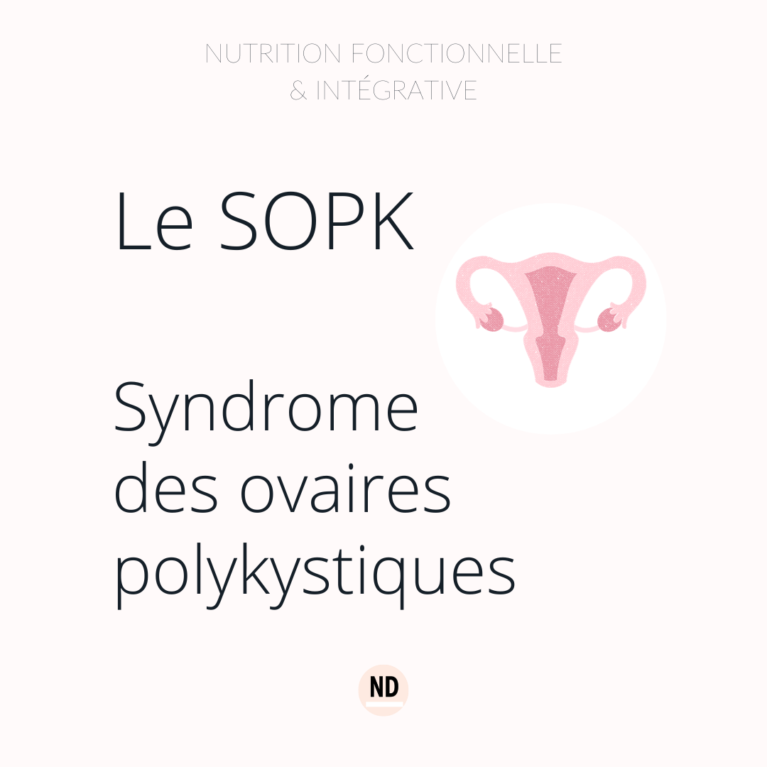 Diététicienne SOPK : la nutrition fonctionnelle dans le soin - Nathalie ...